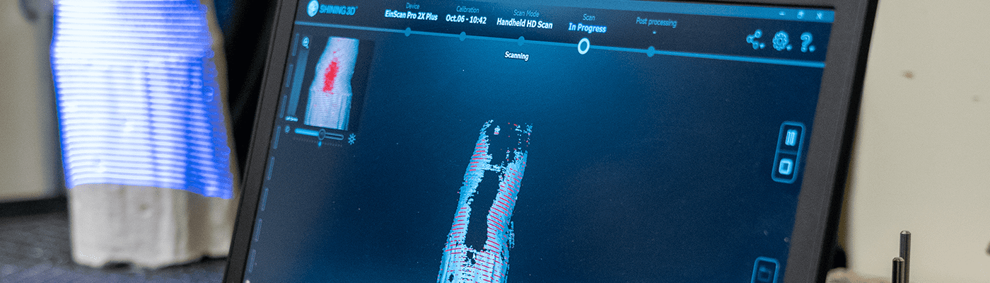 Research Overview: Northwestern University Prosthetics-Orthotics Center ...